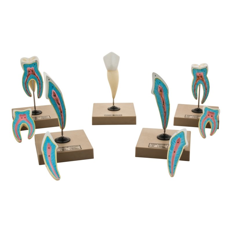 Human Teeth Models - Set of 5 Different Models — SmartLabs