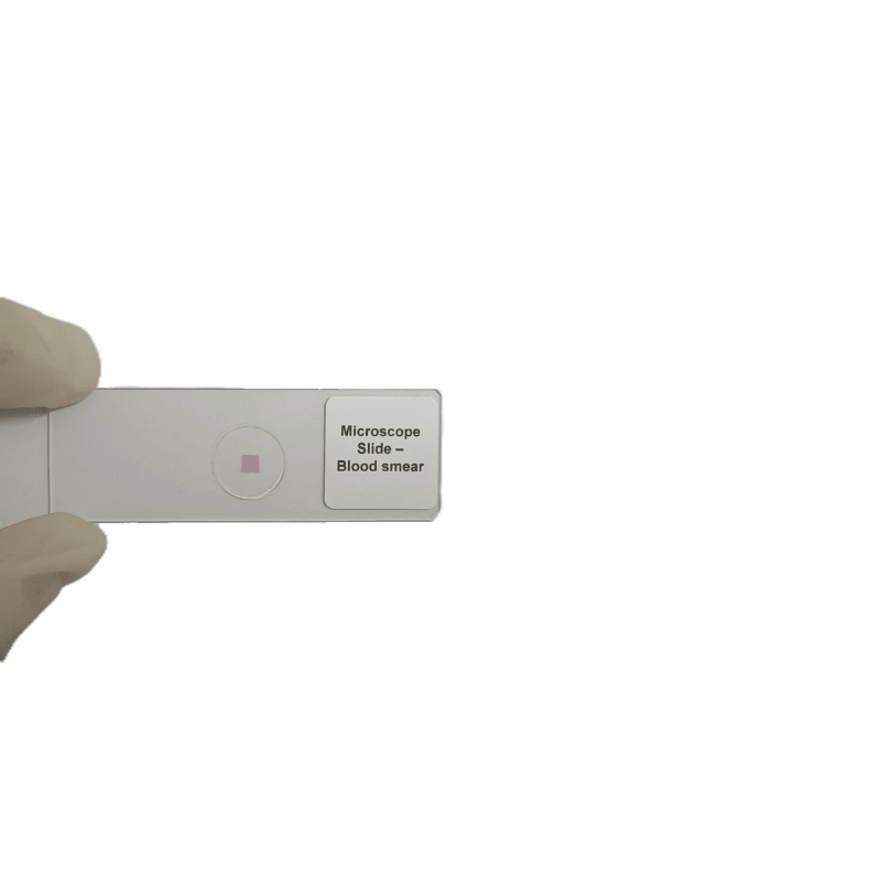 Microscope Slide Blood smear Individually packed in PP slide mailer ...